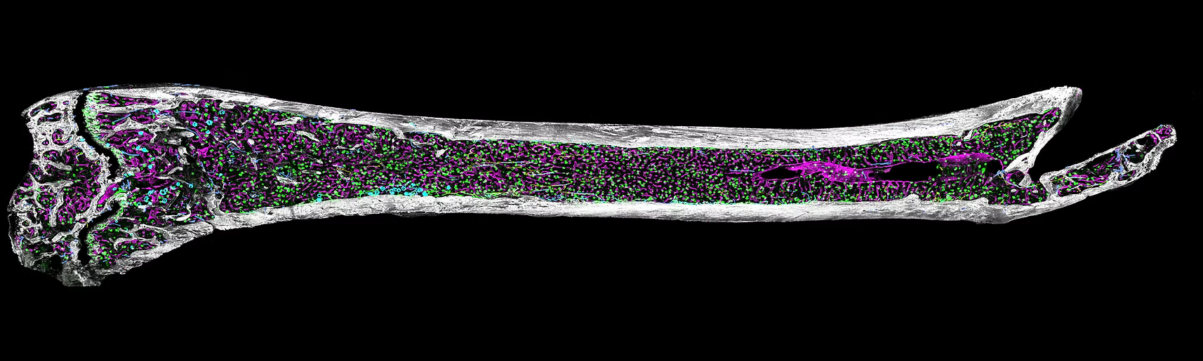 Quantitative Imaging in Oncology | MLO Lab